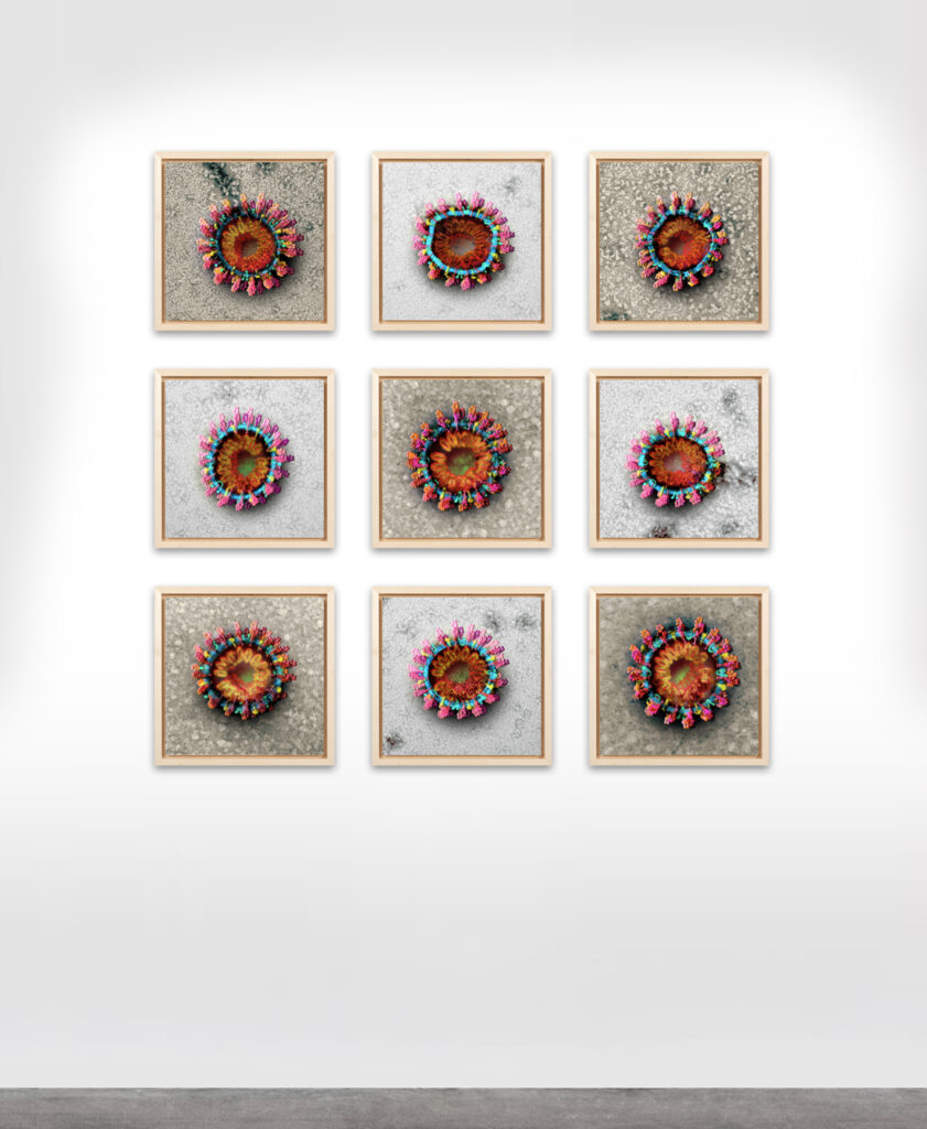 SARS-CoV-2 Fine art | Micronaut: The fine art of microscopy by science ...