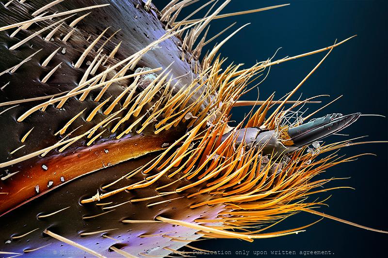 Lethal Weapons | Micronaut: The fine art of microscopy by science ...