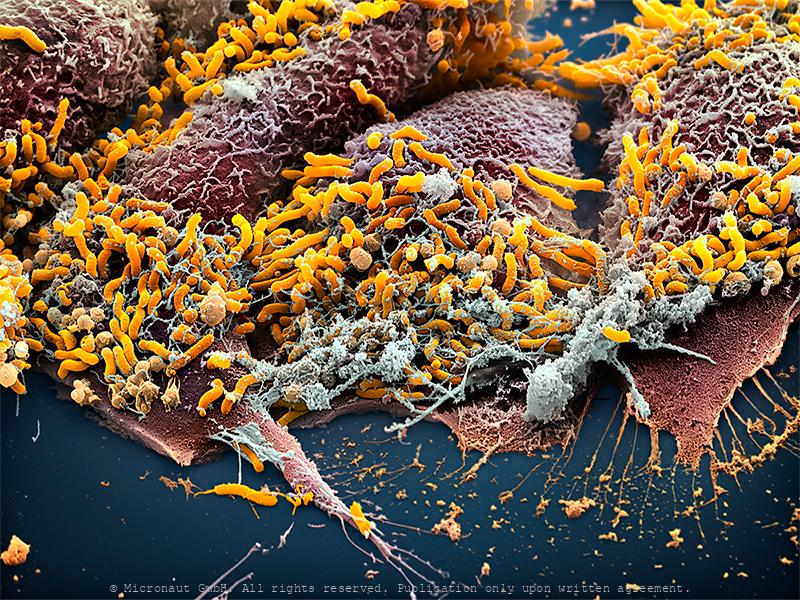 Bacteria (Helicobacter pylori) | Micronaut: The fine art of microscopy ...