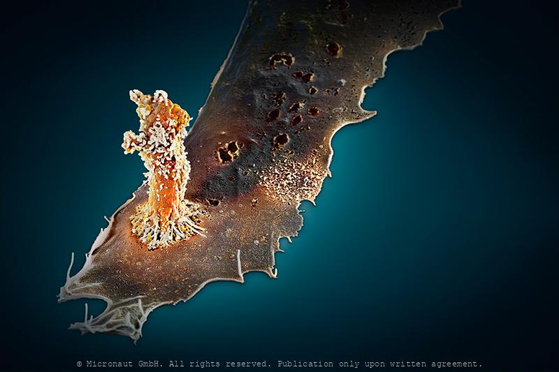 Cell Wars | Micronaut: The fine art of microscopy by science ...