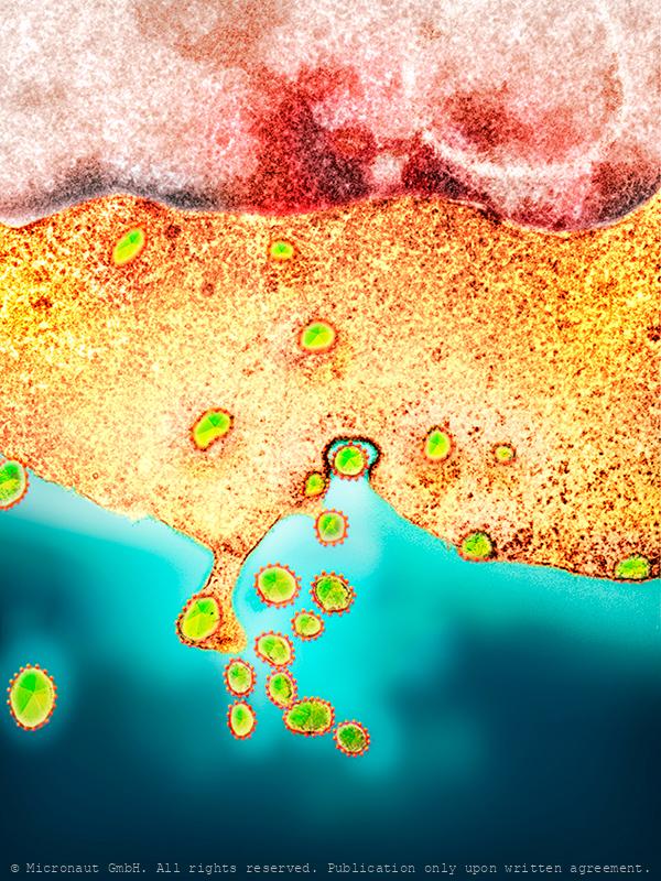 Cell Wars | Micronaut: The fine art of microscopy by science ...