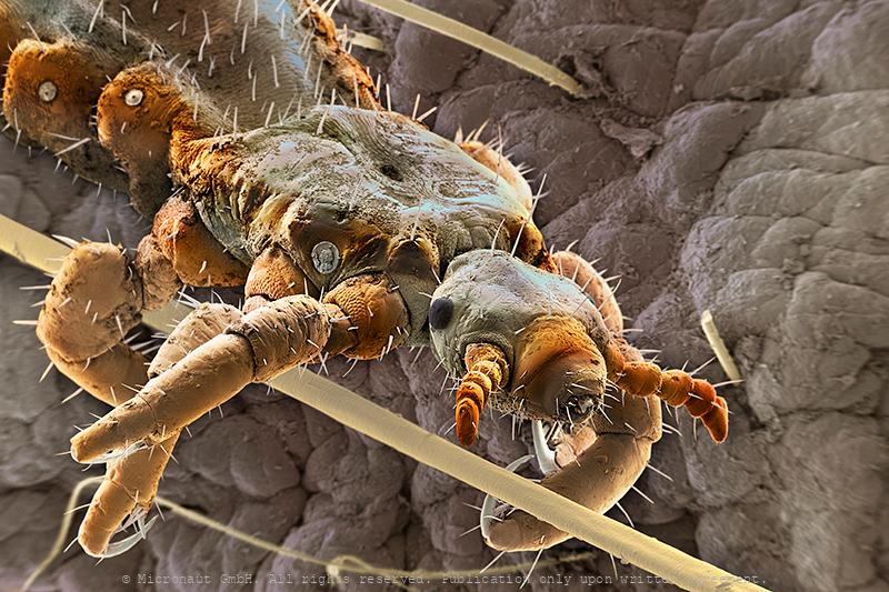 Microcosm I (animals) | Micronaut: The fine art of microscopy by ...