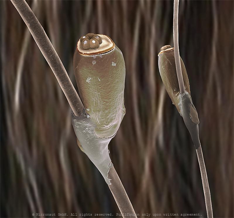 Microcosm I (animals) | Micronaut: The fine art of microscopy by ...