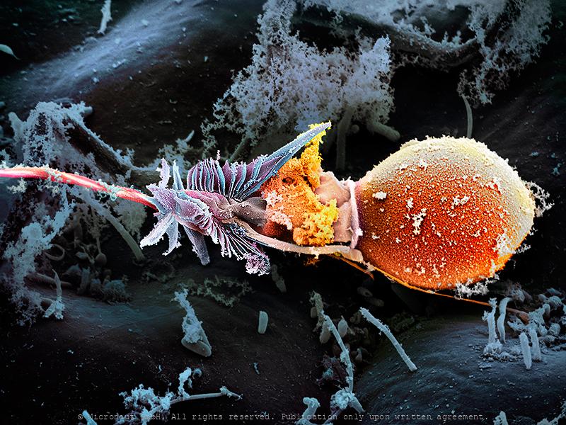 Cell Wars | Micronaut: The fine art of microscopy by science ...