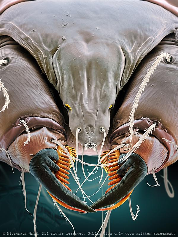 Lethal Weapons | Micronaut: The fine art of microscopy by science ...