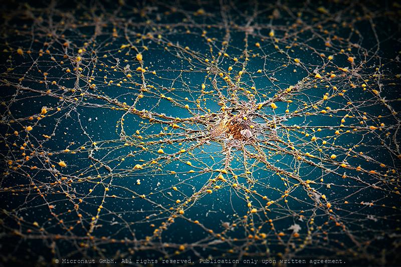 Cell Wars | Micronaut: The fine art of microscopy by science ...