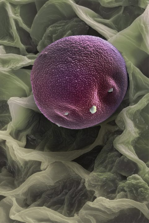 Alder pollen (Alnus sp.) | Micronaut: The fine art of microscopy by ...
