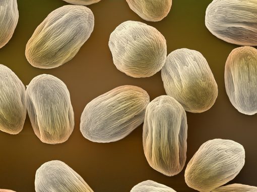 Angel’s Trumpet pollen (Brugmansia sanguinea) | Micronaut: The fine art ...