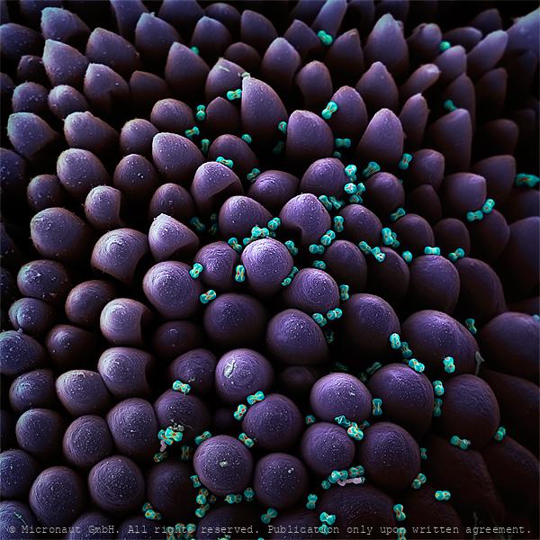 Forget me not pollen (Myosotis sylvatica), Nr.1 | Micronaut: The fine ...
