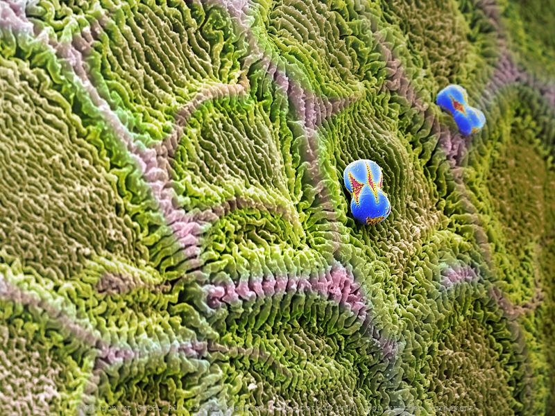 Forget me not pollen (Myosotis sylvatica), Nr.2 | Micronaut: The fine ...