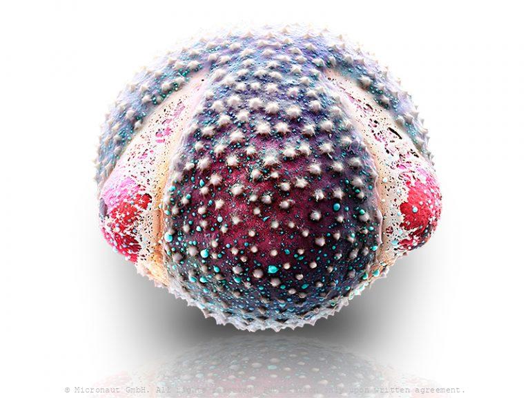 Oak pollen (Quercus petraea) | Micronaut: The fine art of microscopy by ...