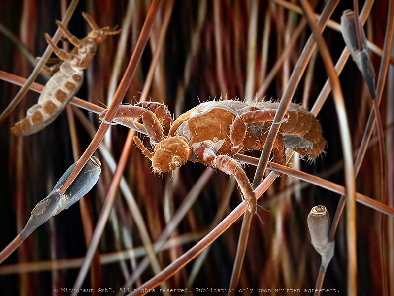 Microcosm I (animals) | Micronaut: The fine art of microscopy by ...
