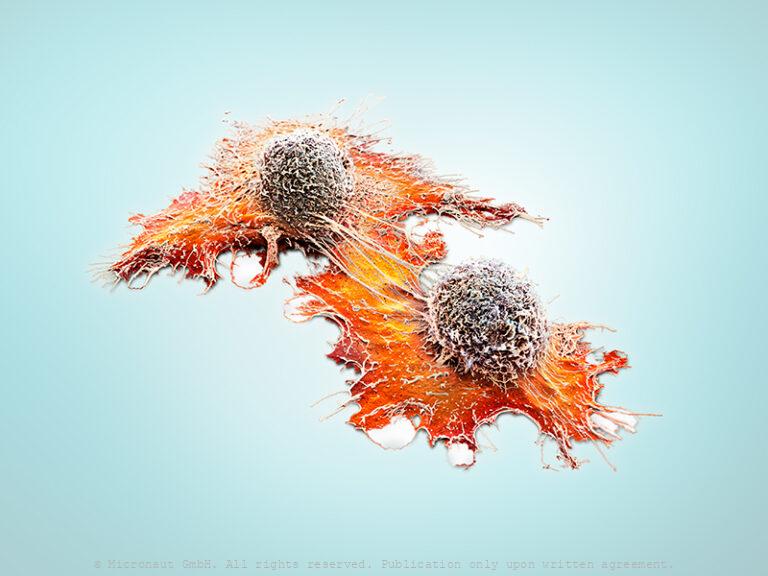 Clonal evolution versus cancer stem cell theory | Micronaut: The fine ...