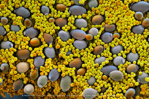 Blastoconidia of Candida albicans | Micronaut: The fine art of ...