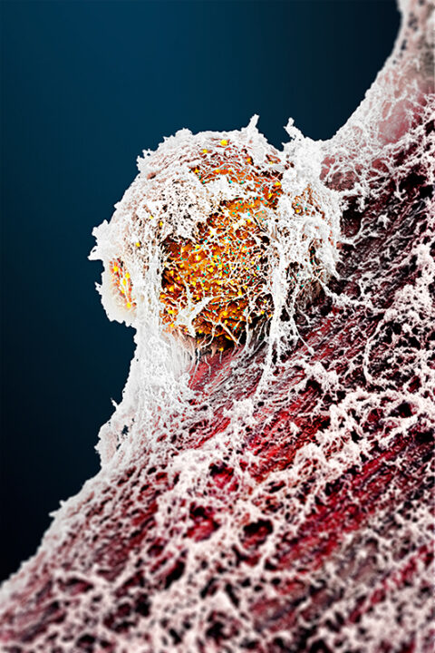 Satellite Cell (Mus musculus) – The Stem Cell that Regenerates t ...