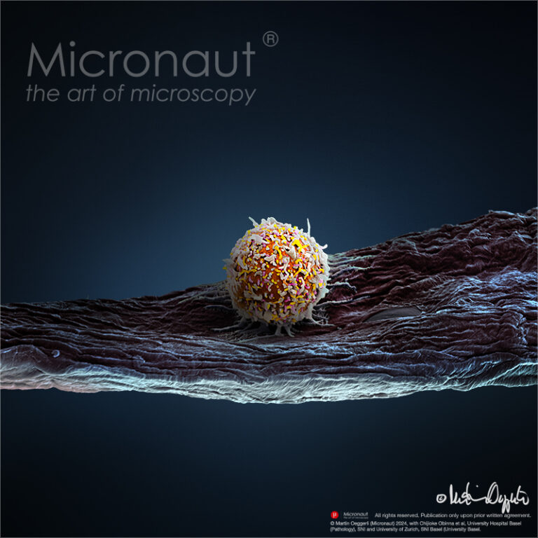 human T cell – engineered immune cell to fight cancer | Micronaut: The fine art of microscopy by ...